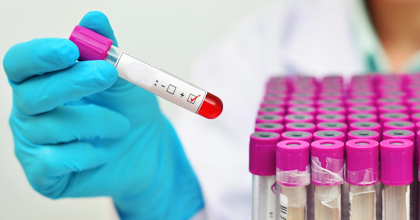 A New Blood Test To Monitor Food Intake